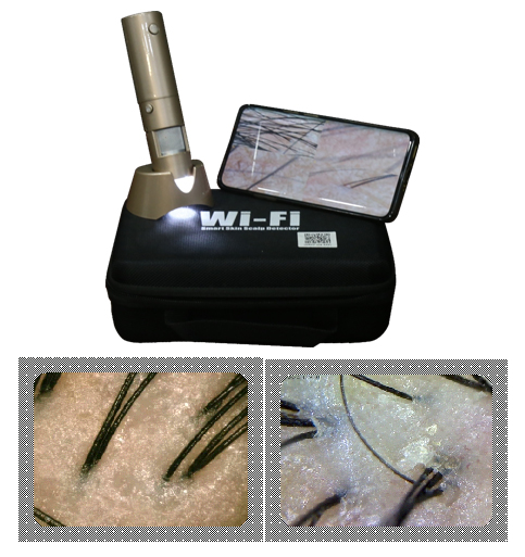 Super Fue Extraction - Medodin